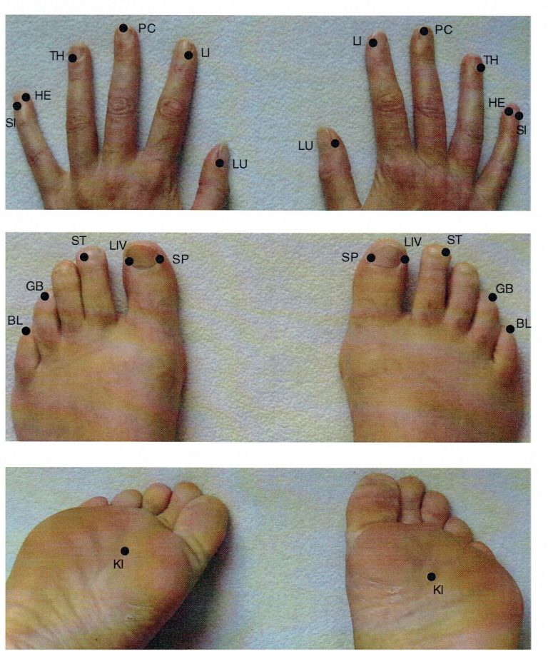 Ting Points - Advanced Photonic Therapy